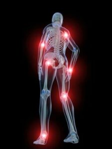 Fibromyalgia vs Polymyalgia Rheumatica: Understanding the Differences ...